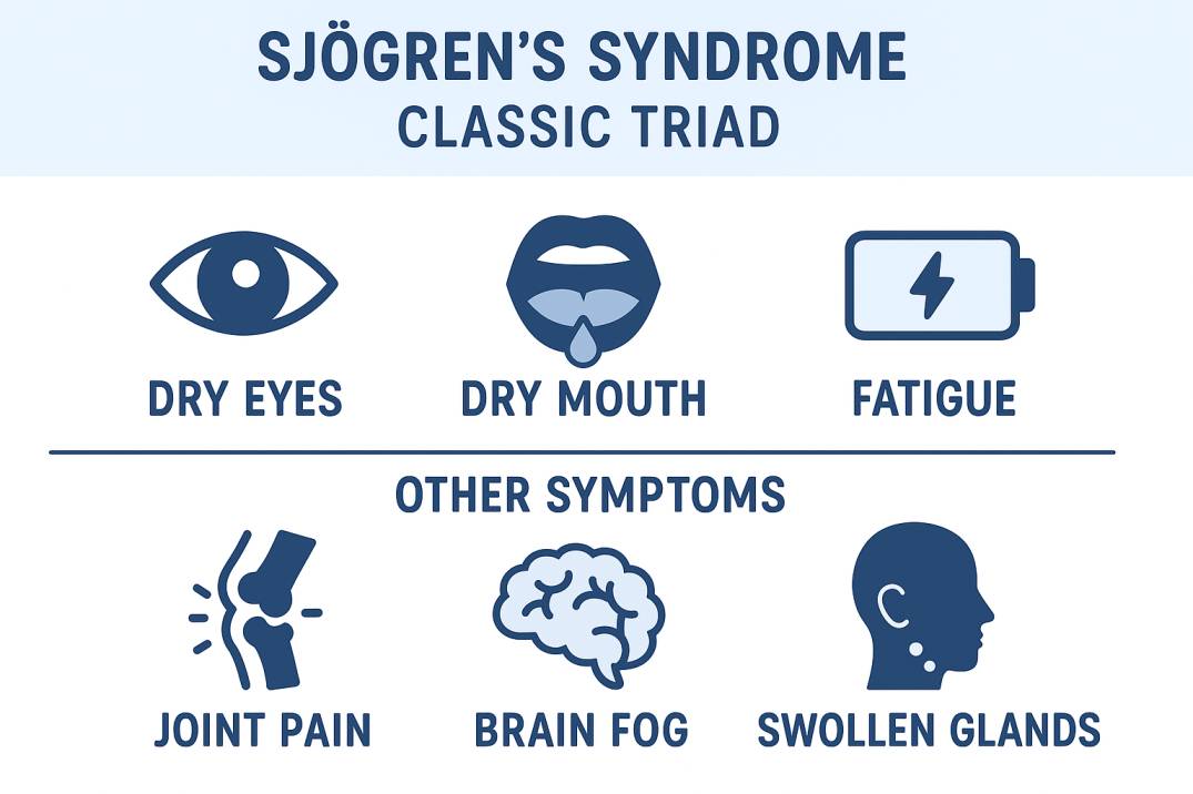 Autoimmune Dry Eye? Understand Sjögren’s Syndrome