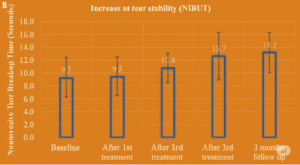 Tixel i Dry Eye Disease Treatment